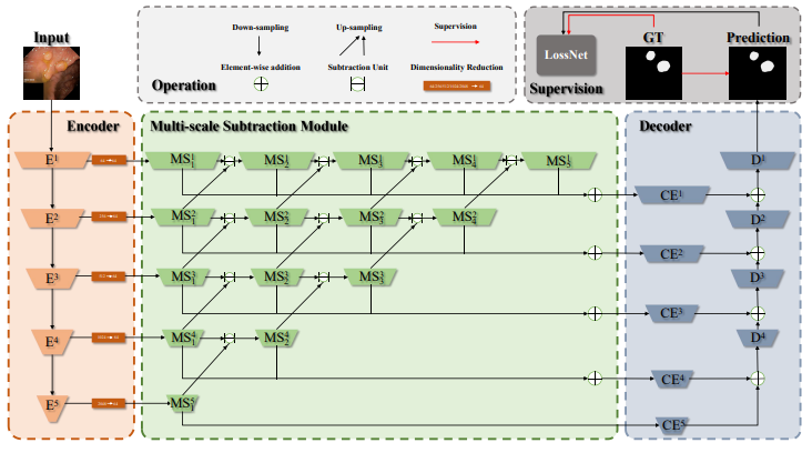 [论文阅读] Automatic Polyp Segmentation via Multi-scale Subtraction Network-CSDN博客