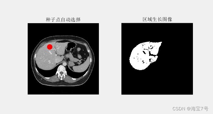 【第 26 章 基于最小误差法和区域生长的医学影响分割系统 Matlab深度学习实战gui项目】基于matlab Gui的医用系统开发 Csdn博客