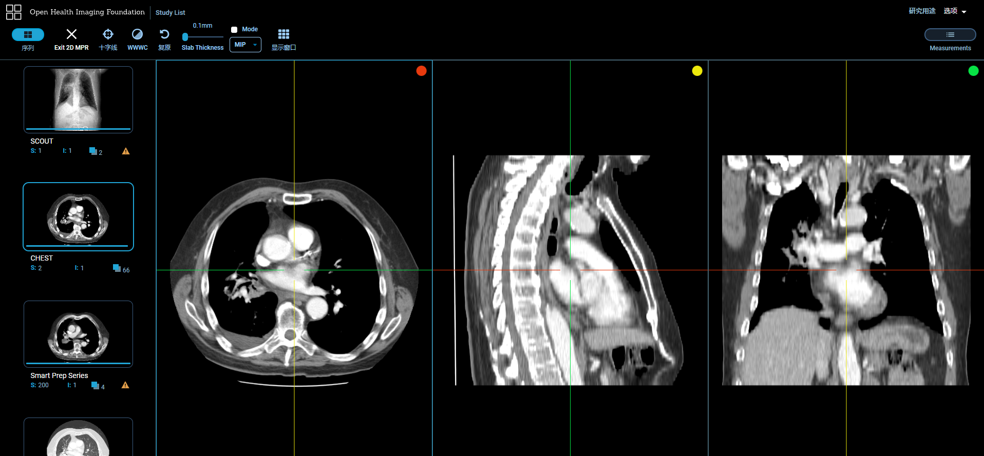 OHIF Medical Imaging Viewer 安装_production 版本的 ohif viewer怎么修改配置项-CSDN博客