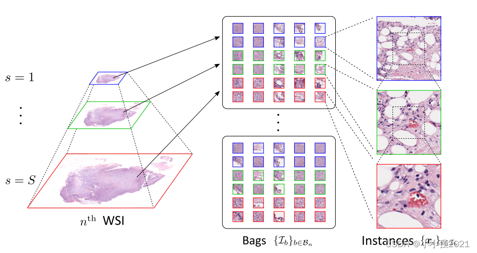 论文阅读：Multi-scale Domain-adversarial Multiple-instance CNN for Cancer Subtype Classiﬁcation with ...
