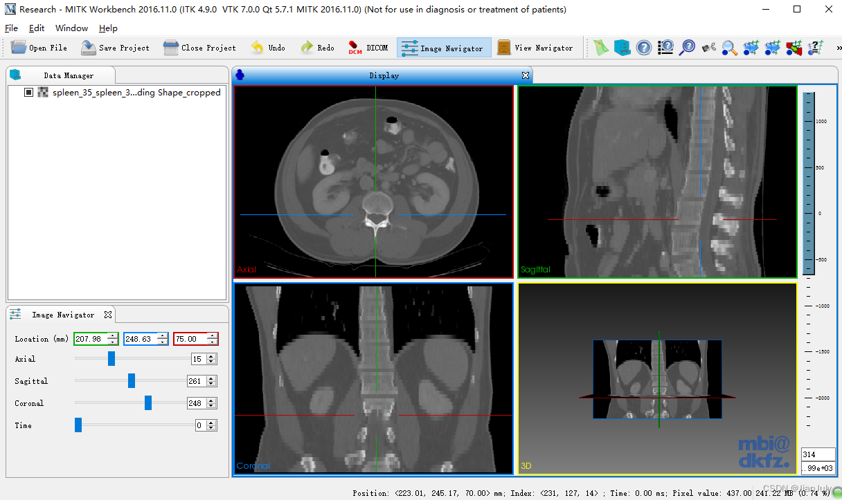 【SimpleITK教程】GetSize()方法和GetArrayFromImage()方法-CSDN博客