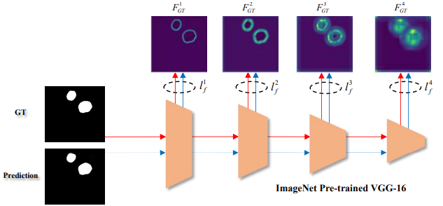 [论文阅读] Automatic Polyp Segmentation via Multi-scale Subtraction Network-CSDN博客