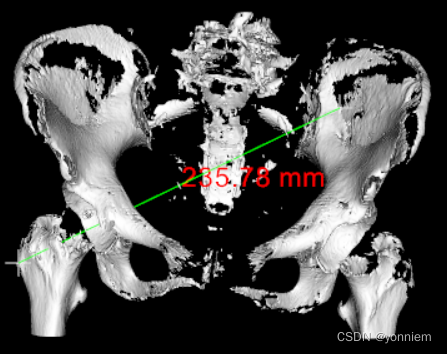 利用vtk测量DICOM三维模型的空间物理尺寸_vtkdistancerepresentation3d-CSDN博客