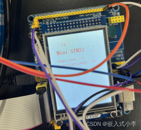 stm32项目（7）——基于stm32的智能床的控制与设计_stm32f03rct6设计液晶屏显示滑动变阻器转动-CSDN博客