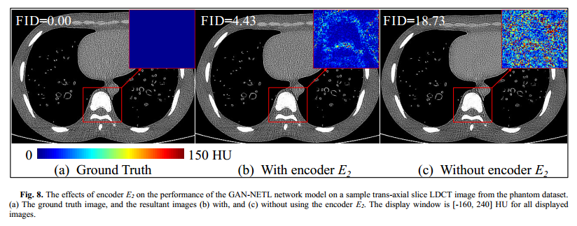 Low-dose CT Image Synthesis for Domain Adaptation Imaging Using a ...