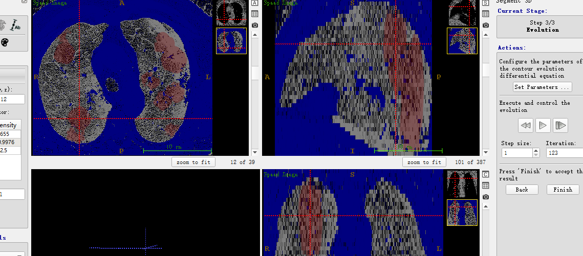 ITK-Snap 处理医疗影像-CSDN博客