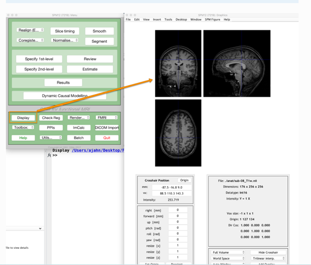 基于spm12对fMRI数据分析_spm12的tpm-CSDN博客