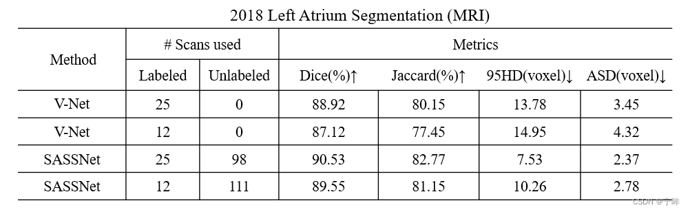 半监督3D医学图像分割（四）：SASSNet_shape-aware semi-supervised 3d semantic segmentati-CSDN博客