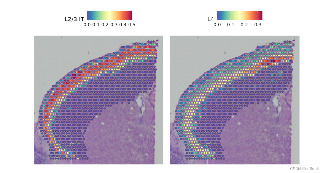跟着Seurat官网学空间转录组（10X数据集为例，包含细胞映射，无监督学习）_seurat空间转录组-CSDN博客