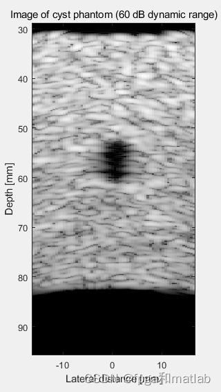 使用Field_II_ver_3_24_windows_gcc工具箱实现超声波数据成像matlab仿真_python fieldii 库-CSDN博客