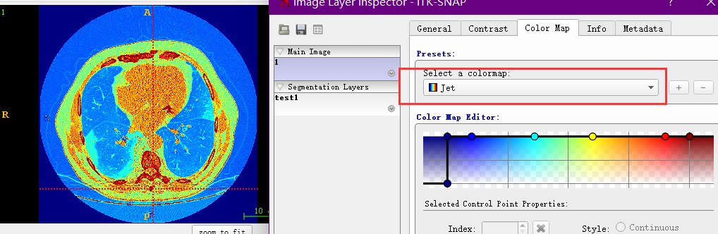 ITK-Snap 处理医疗影像-CSDN博客