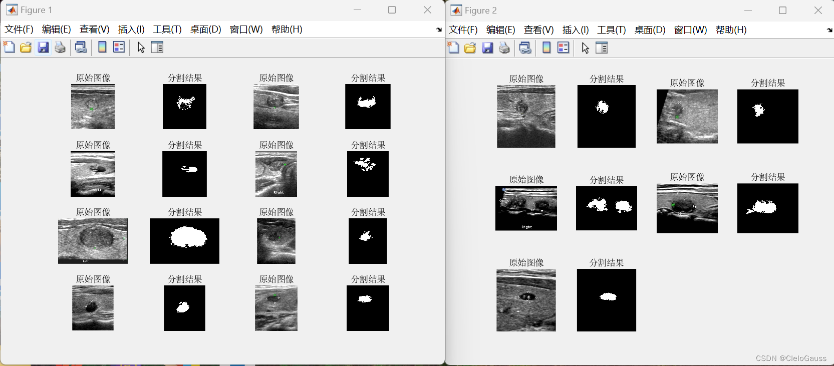 图像分割及其实现过程（matlab篇 代码） Gac模型代码 Csdn博客