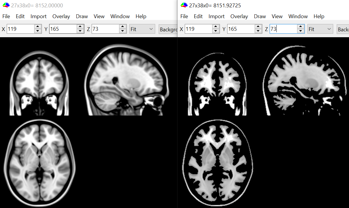 MRI脑影像分析——多种工具实现Nifti(*.nii)文件读取、处理与写入——把小舞写进脑海里、6mm半高全宽高斯核平滑脑影像、NIFTI ...