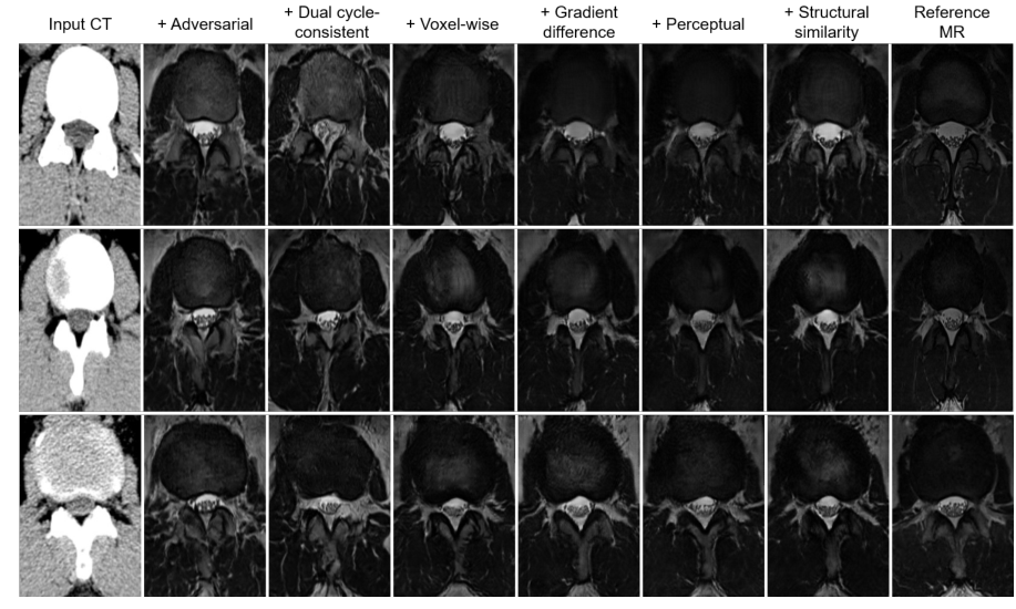 CT图像转MR图像_基于ct图像合成虚拟mri图像-CSDN博客