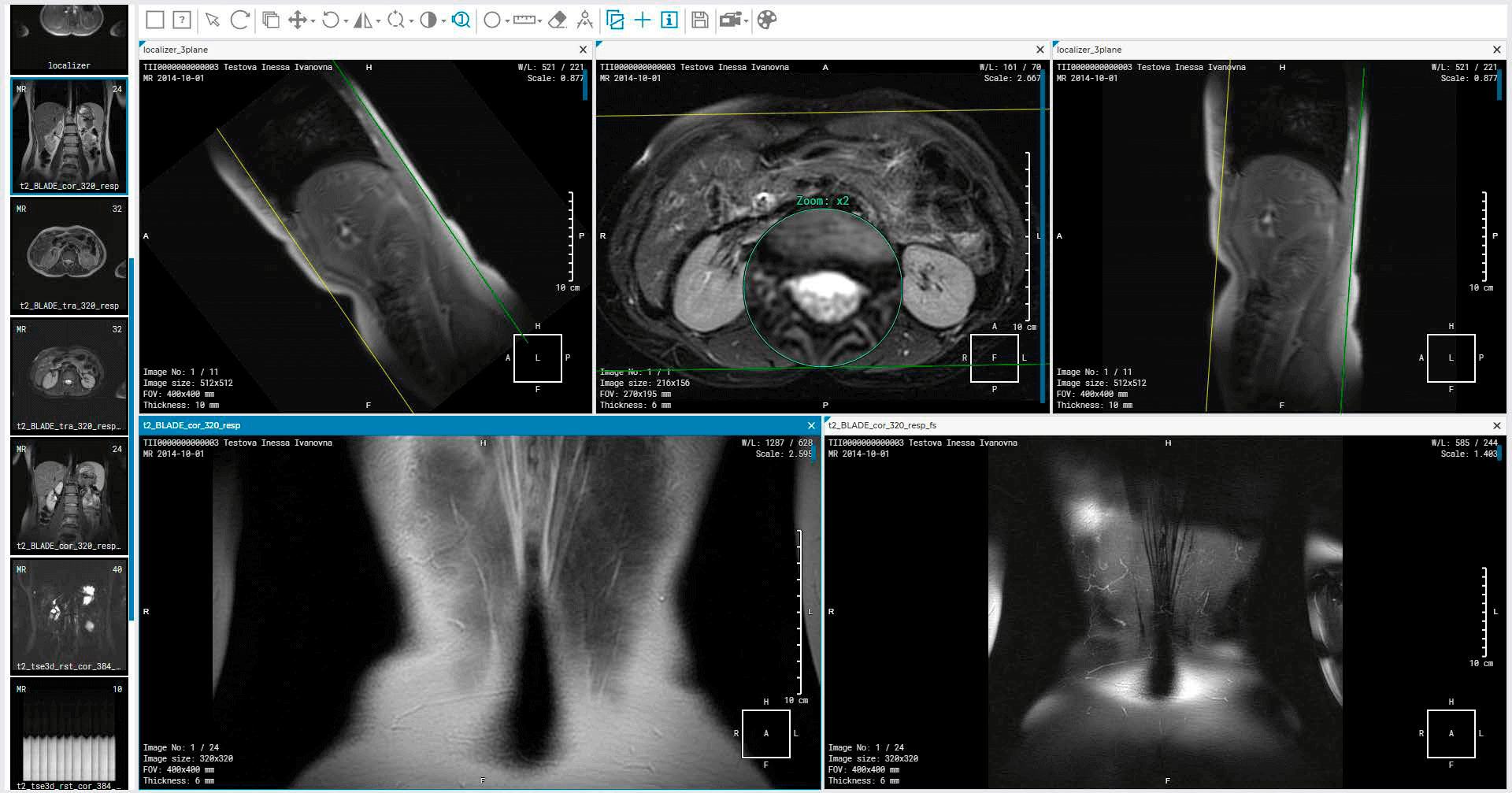 Inobitec DICOM Viewer Pro 2.6.1-CSDN博客