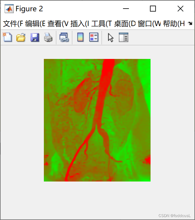 matlab图像处理作业分析 colormap的创建_imshow “colormap”-CSDN博客