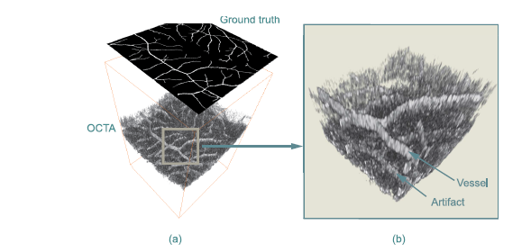 Image Projection Network: 3D to 2D ImageSegmentation in OCTA Images 论文 ...