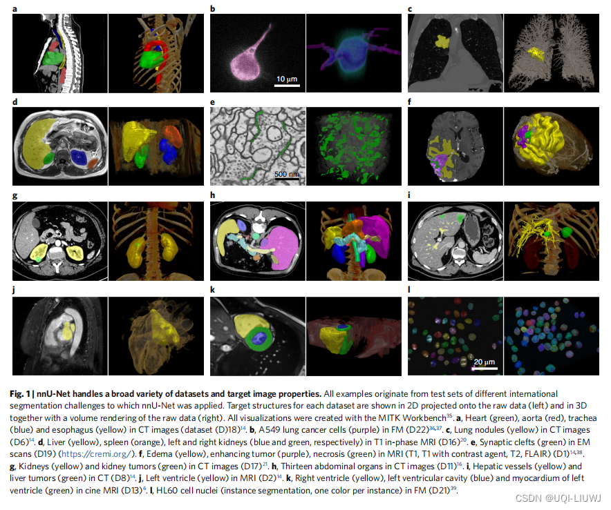 论文笔记:nnu Net A Self Configuring Method For Deep Learning Based Biomedical Image Segmentation Csdn博客