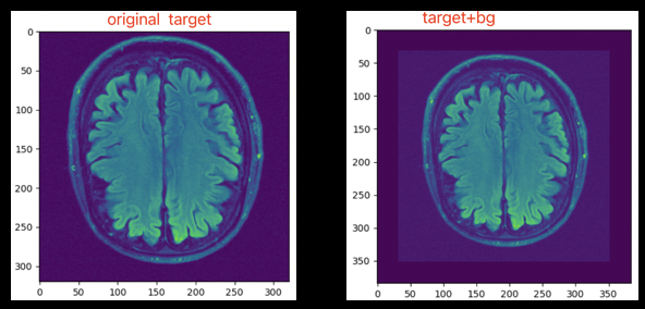 pg_mri----brain reconstruction_kspace 转换到image-CSDN博客
