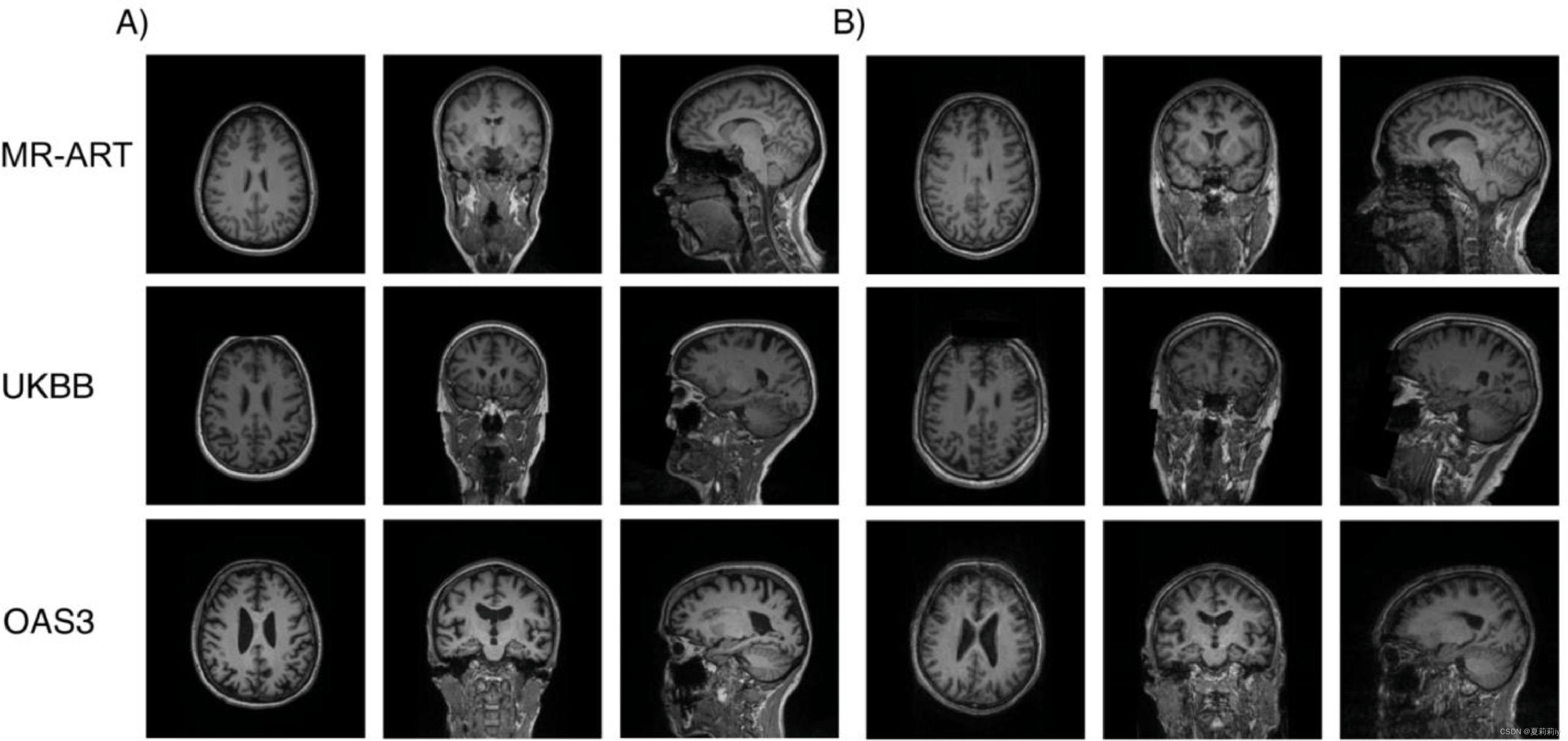 [论文精读]Automatic brain MRI motion artifact detection based on end-to-end ...