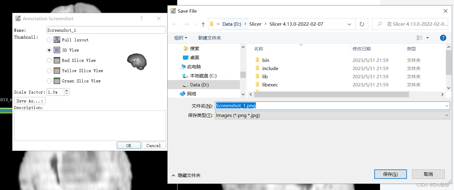 3DSlicer安装及学习_3d slicer读取nii图像-CSDN博客