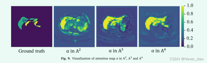 Multi-organ segmentation network for abdominal CT images based on spatial attention and ...