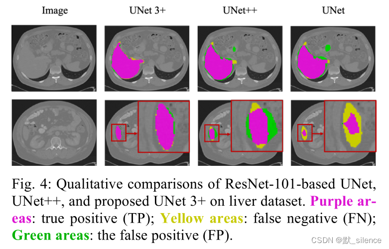论文解析[4] UNET 3+: A FULL-SCALE CONNECTED UNET FOR MEDICAL IMAGE SEGMENTATION_unet3+包含分类引导模块吗-CSDN博客