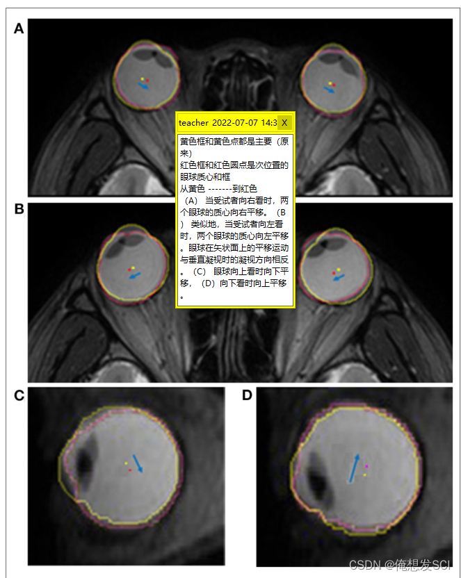 Positional Change of the Eyeball During Eye Movements: Evidence of ...