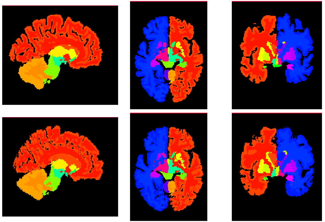 VoxelMorph-无监督医学图像配准-代码讲解_MaybeRichard的博客-CSDN博客