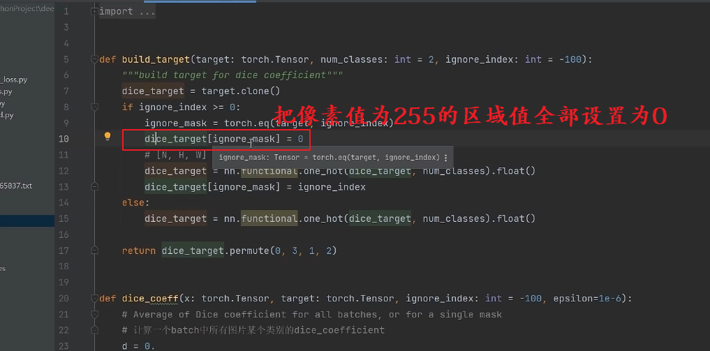 使用Pytorch搭建U-Net网络并基于DRIVE数据集训练(语义分割)学习笔记-CSDN博客
