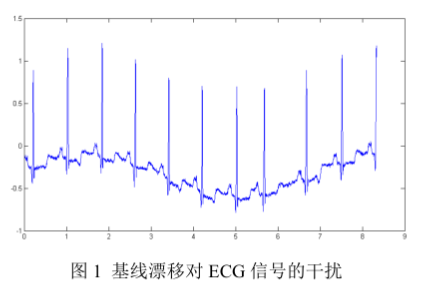 【20220124】【信号处理】ECG信号预处理及信号筛选方法_ecg信号处理-CSDN博客