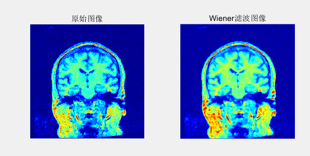 Wiener滤波器---MATLAB_matlab中计算维纳滤波的频域公式-CSDN博客
