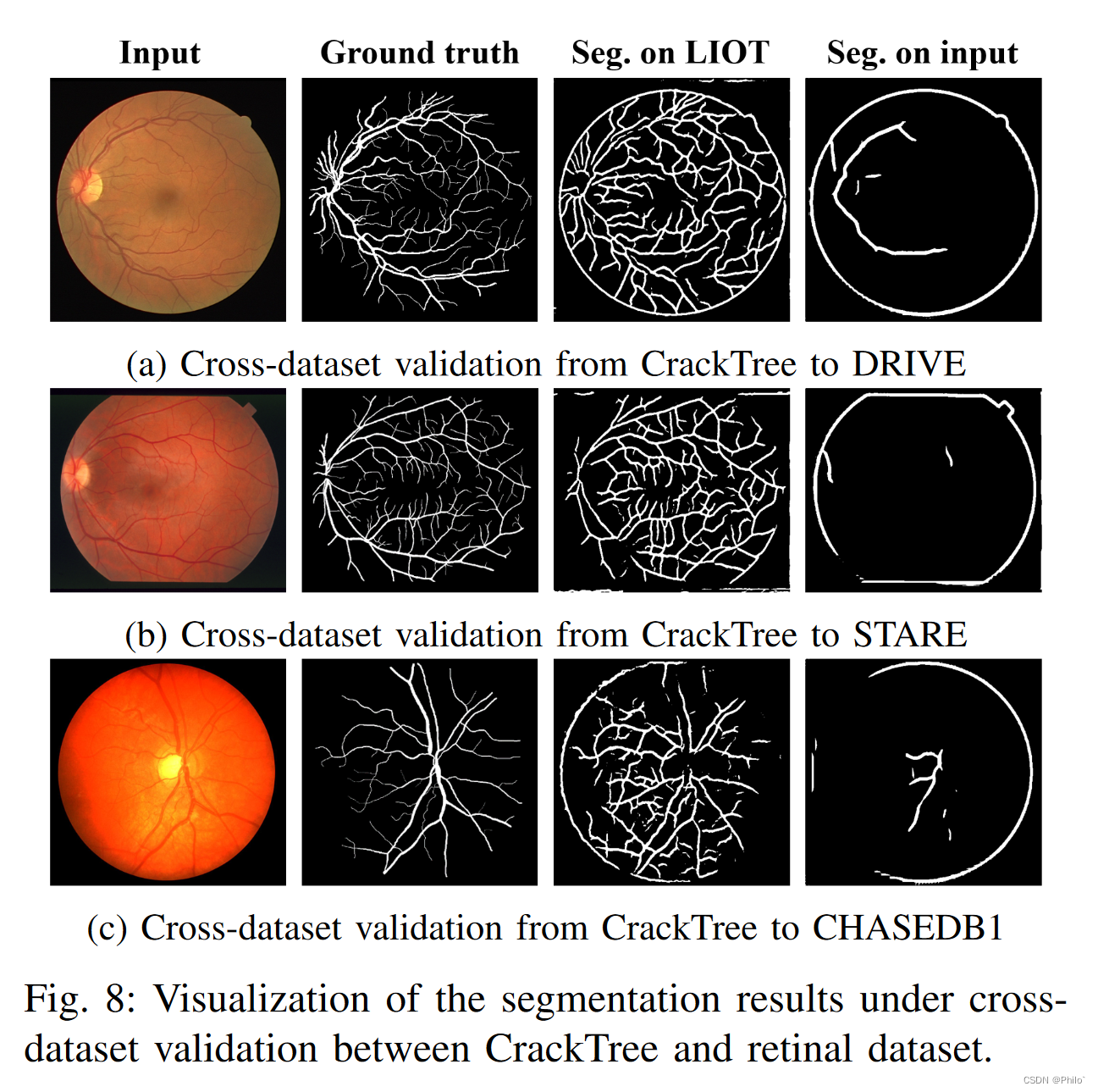 Local Intensity Order Transformation for Robust Curvilinear Object Segmentation(LIOT)-CSDN博客