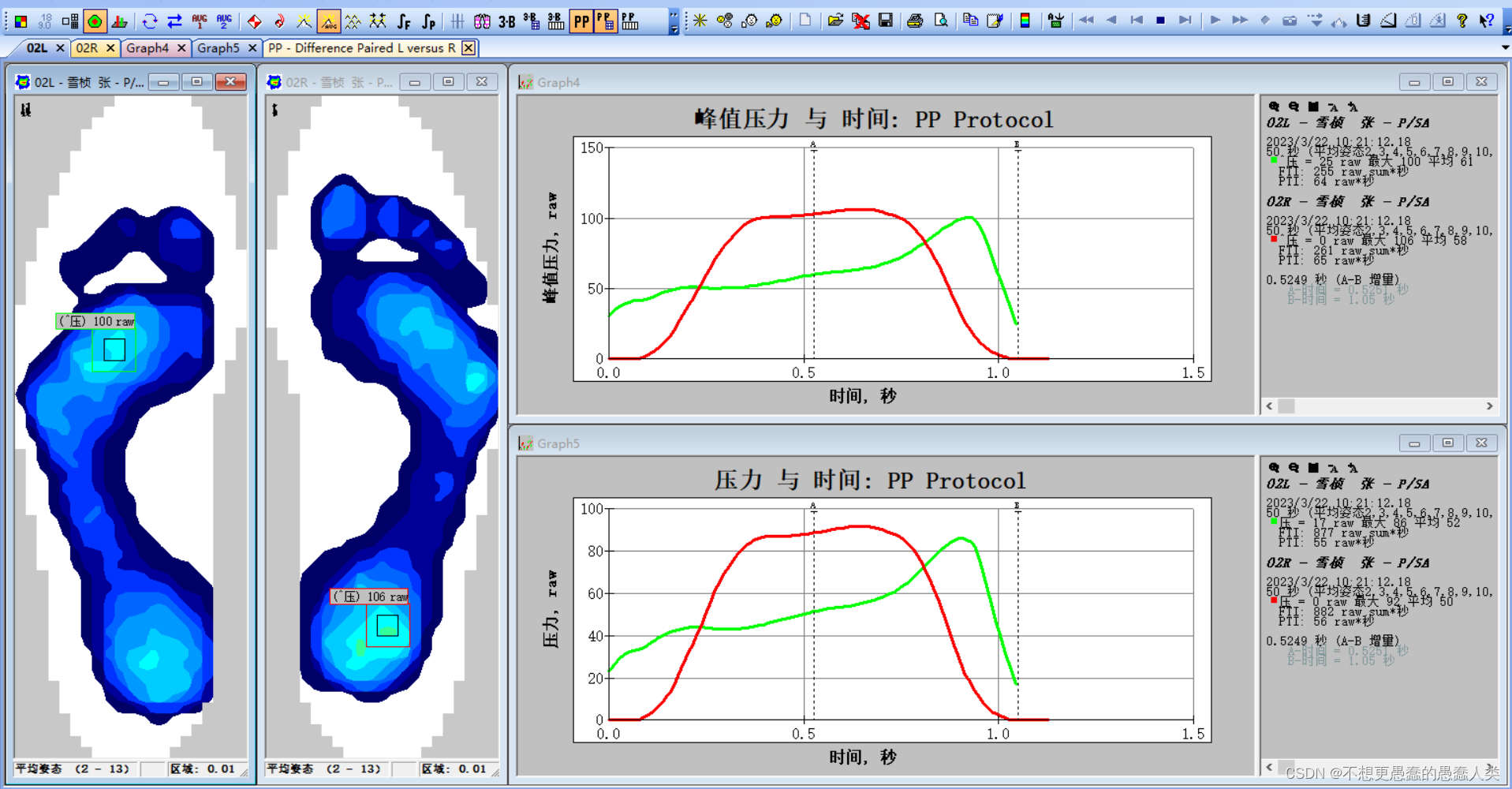 f-scan足底分析三：3-Box分析、峰值压力分析、murphy 4P方法_foot axis-CSDN博客