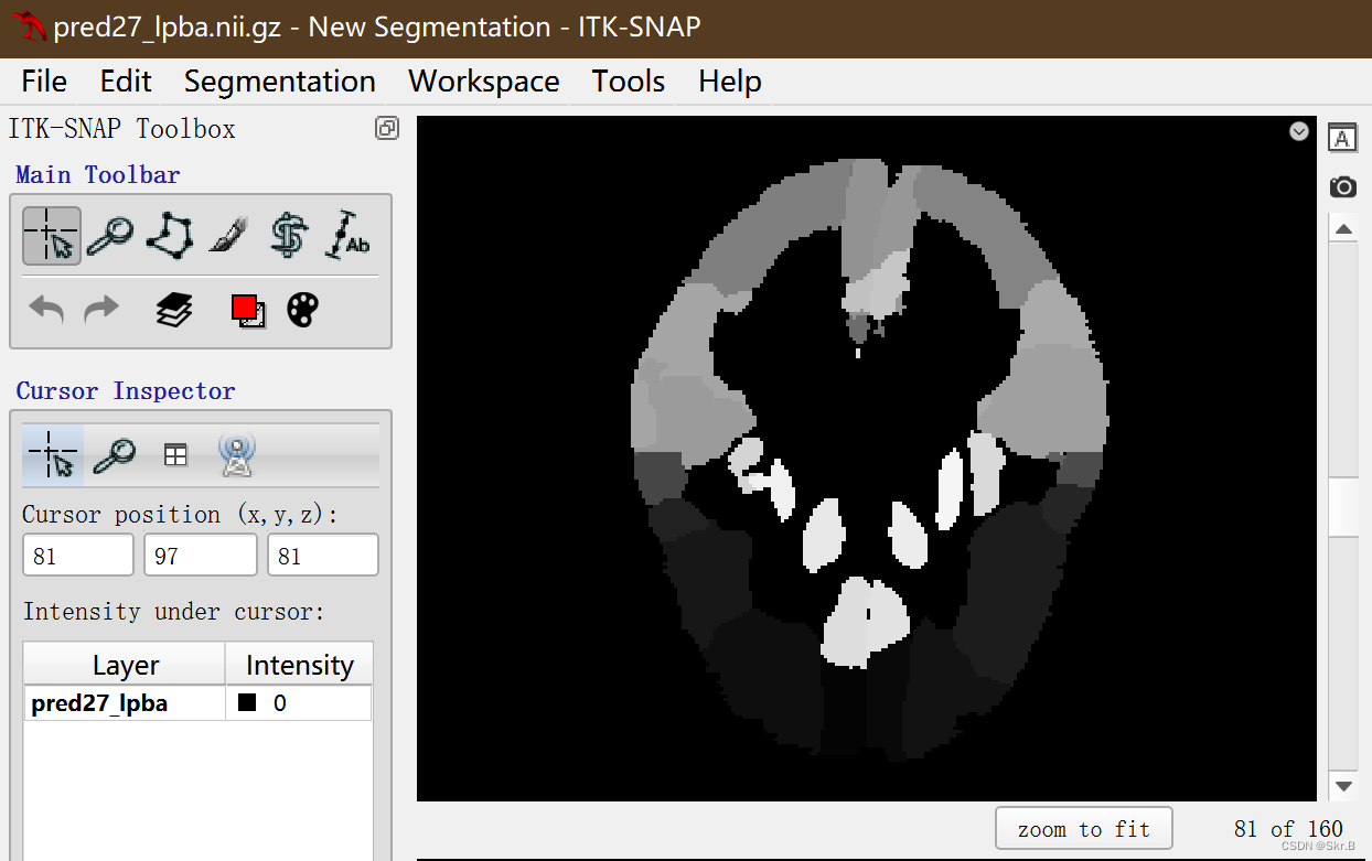 使用 ITK-Snap 截取 3D 图像的一个干净的截面_itksnap截取某个部分-CSDN博客