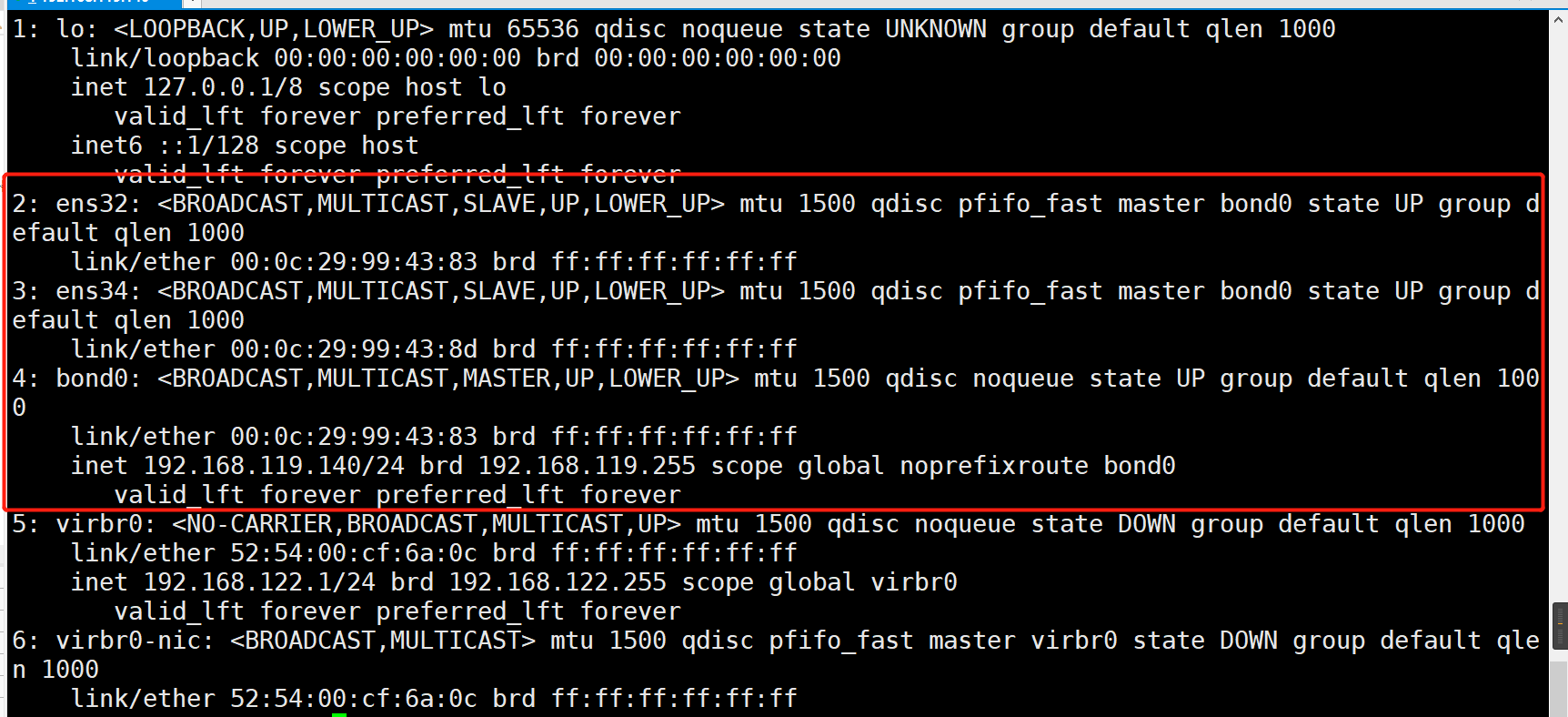 基于Centos7环境下配置bond1配置_centos bond1-CSDN博客