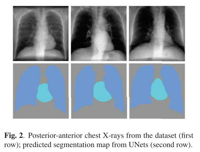 论文阅读：CCX-RAYNET: A CLASS CONDITIONED CONVOLUTIONAL NEURAL NETWORK FOR ...
