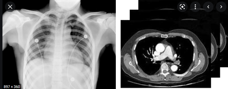 Radon变换与Matlab代码_radon变换 正弦图-CSDN博客