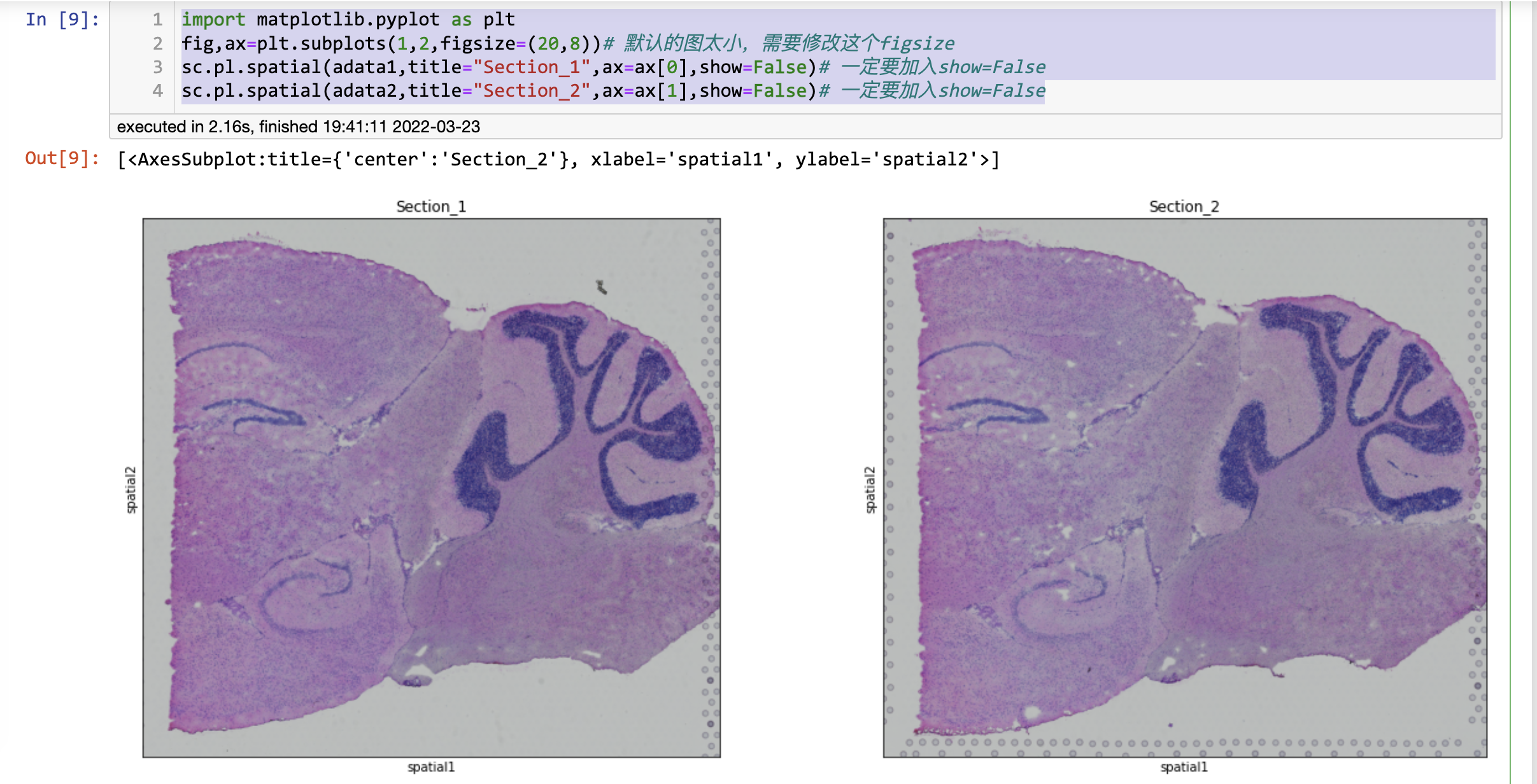 空间转录组并列画图测试1_sc.pl.spatial-CSDN博客