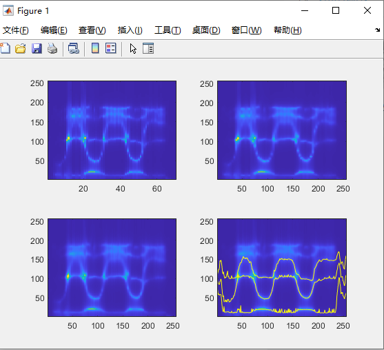 【共振峰跟踪】通过平均不同分辨率的方法跟踪共振峰，基于时频lpc的频谱图的MATLAB仿真_lpc编码与matlab仿真-CSDN博客