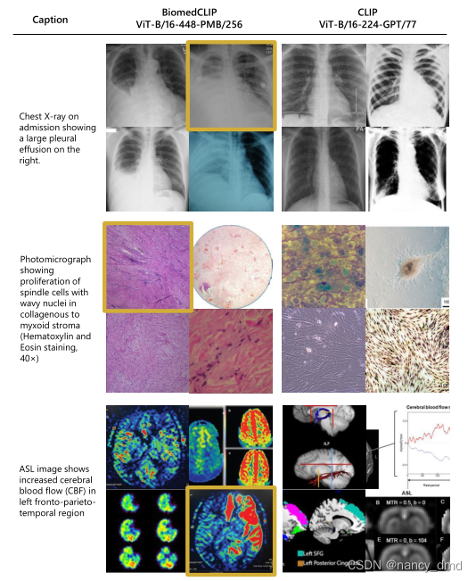 【论文阅读】LARGE-SCALE DOMAIN-SPECIFIC PRETRAINING FOR BIOMEDICAL VISION-LANGUAGE PROCESSING-CSDN博客