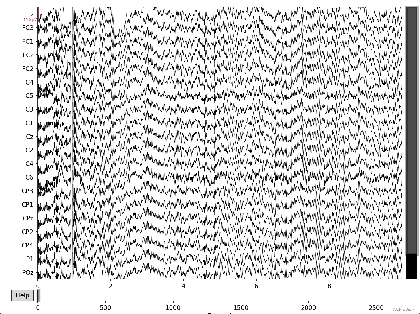 BCI Competition IV 2a数据集.gdf文件读取与预处理-CSDN博客