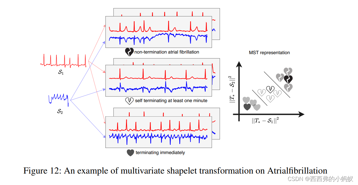 ShapeNet: A Shapelet-Neural Network Approach forMultivariate Time Series Classification（AAAI2021 ...