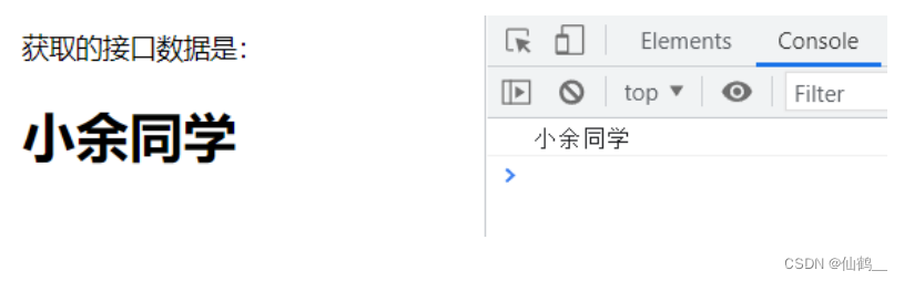 Vue接口调用方式vue请求接口 Csdn博客