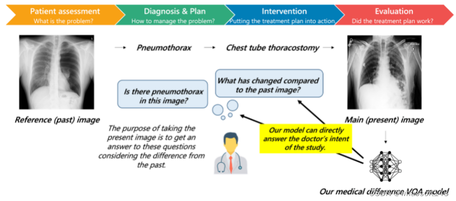MIMIC-Diff-VQA_mimic cxr数据集可以做什么任务-CSDN博客