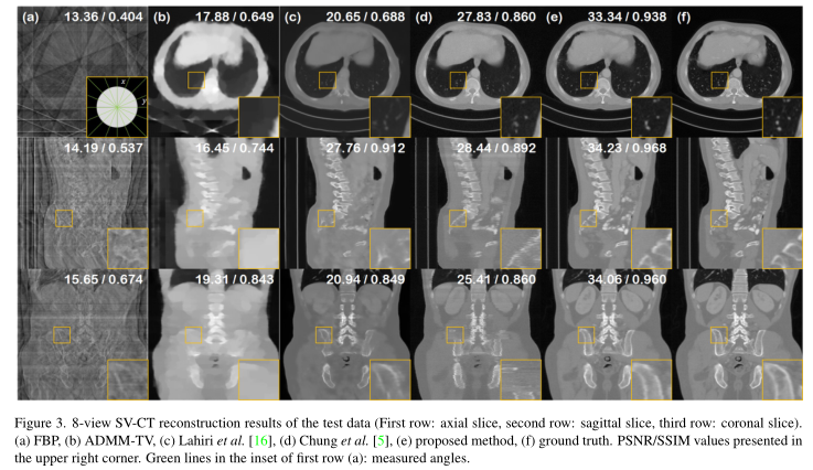 Solving 3D Inverse Problems using Pre-trained 2D Diffusion Models-CSDN博客