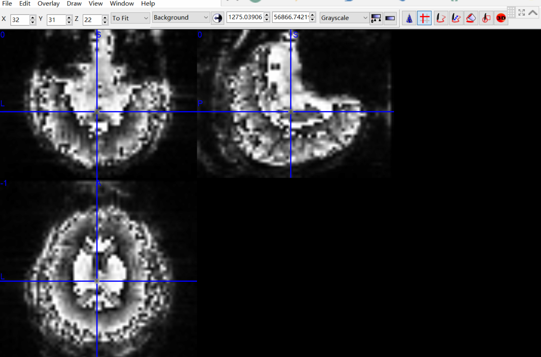 影像数据库 | ADNI数据下载/分析_adni数据库-CSDN博客