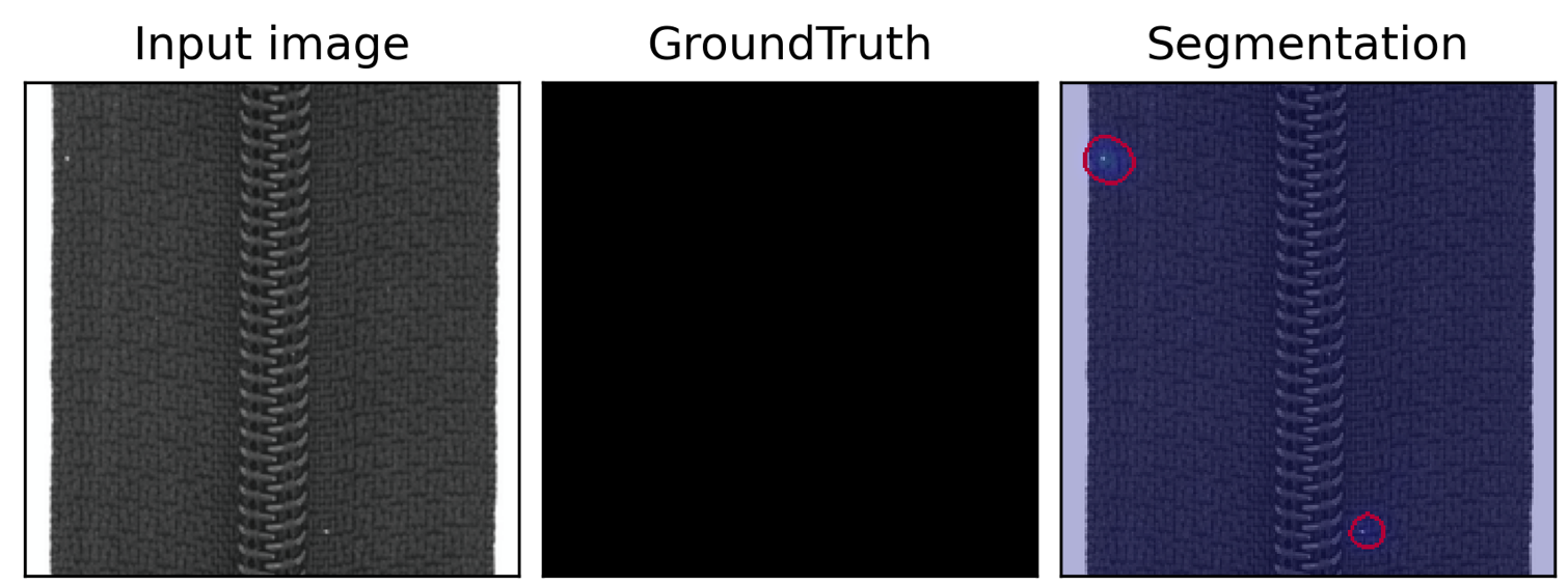 【阅读笔记】《Student-Teacher Feature Pyramid Matching for Anomaly Detection》_student-teacher feature ...