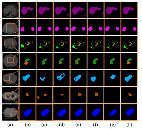 [深度学习论文笔记DoDNet: Learning to segment multi-organ and tumors from multiple partially labeled ...