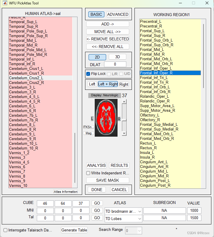 制作指定脑区的maks(包括重采样)_wfu pickatlas-CSDN博客